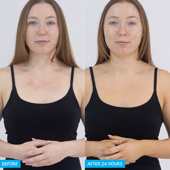 Natural Self Tanning Mousse | Healthy Ingredients | East Application ...